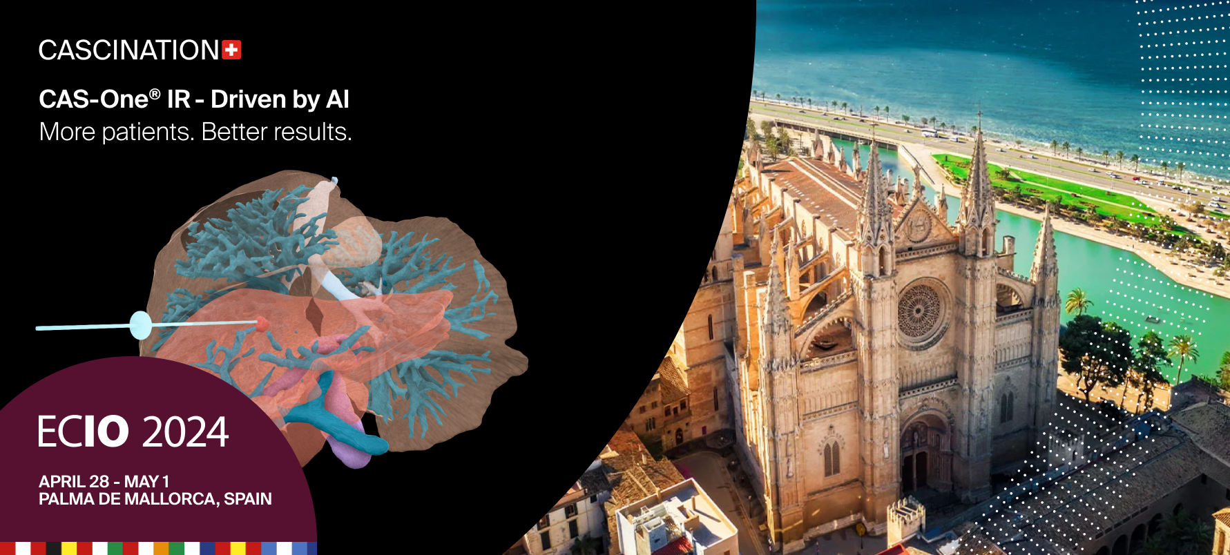 ECIO in Palma - An Ablation Lover's Guide