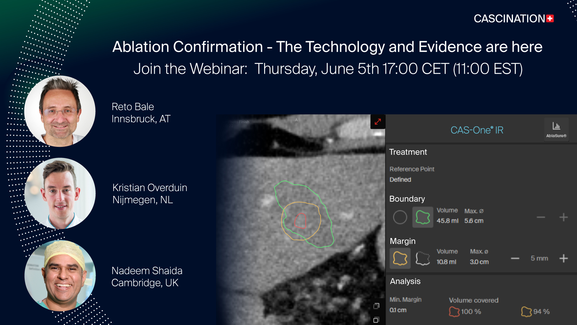 CAS-One IR - Driven by AI
