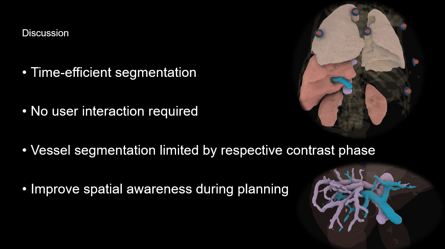 AI Based Segmentation with CAS-One IR