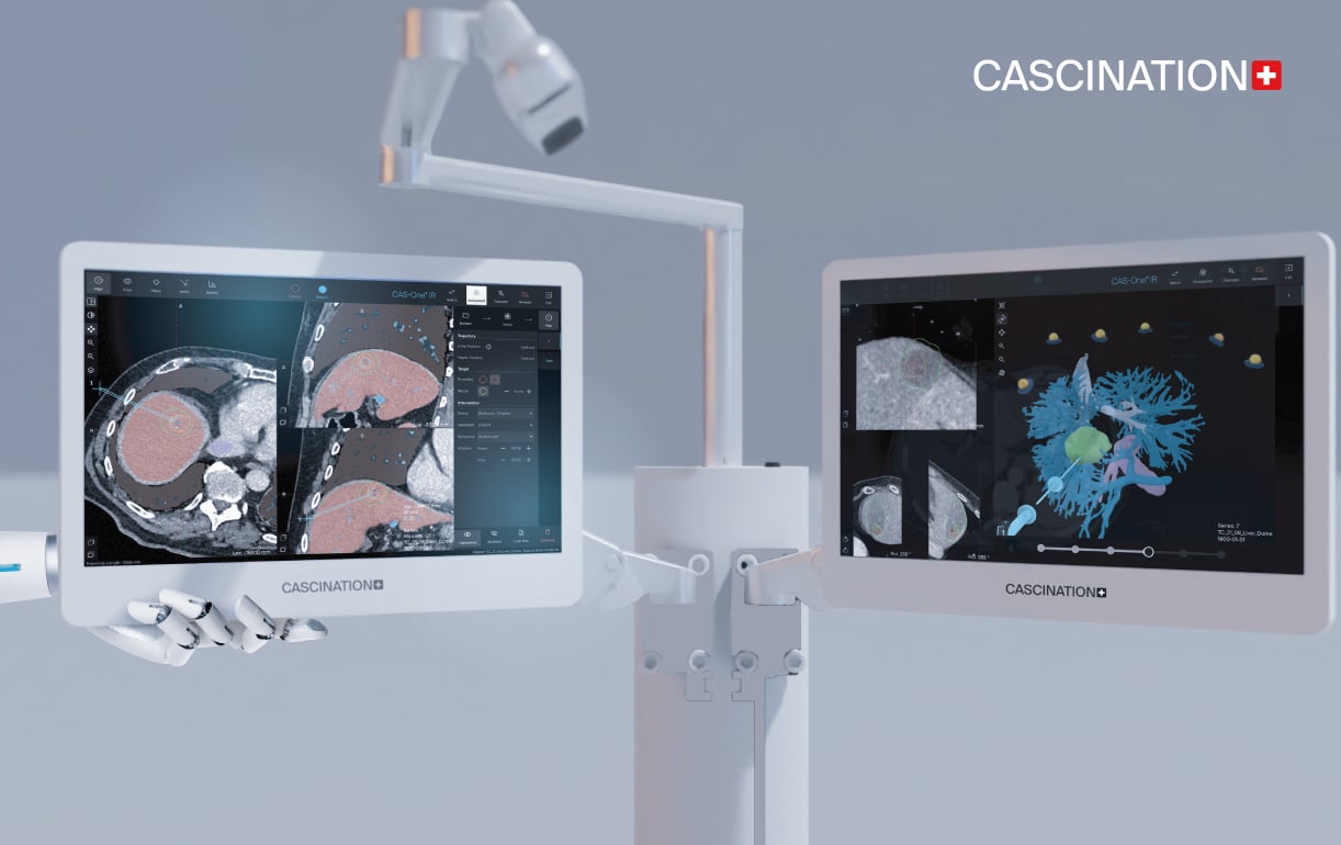 CAS - One IR 4.3 - Driven by AI