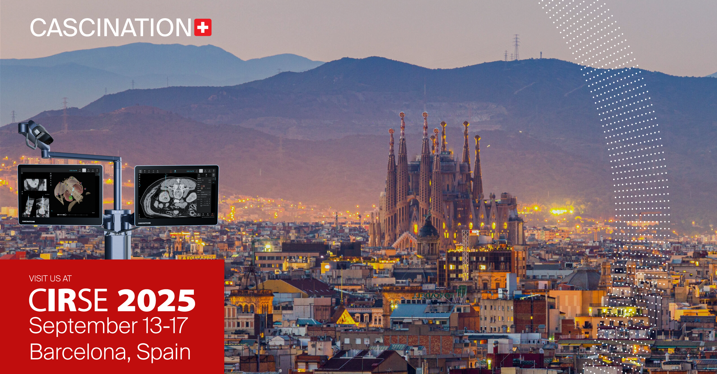 The Ablation Guide: CIRSE Barcelona 2025
