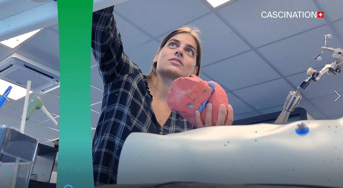 6,000 patients treated with CAS-One IR