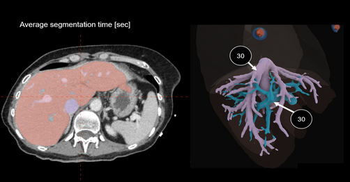 AI Based Segmentation with CAS-One IR